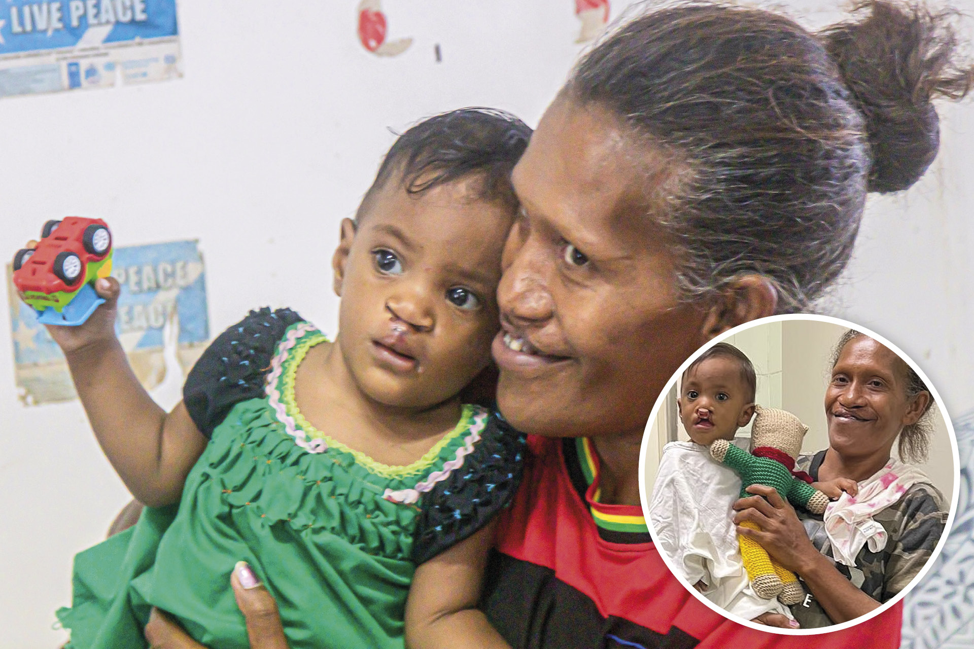 Interplast: Rotary’s best kept success storyInterplast • Rotary Down Under